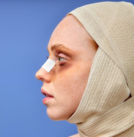 Rhinoplasty Recovery Timeline | Dr. Anthony Bared