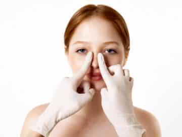 Managing Scar Tissue with Revision Rhinoplasty | Miami, FL